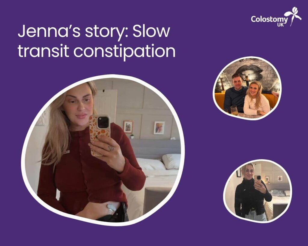 Slow transit constipation: Jenna’s story - Colostomy UK